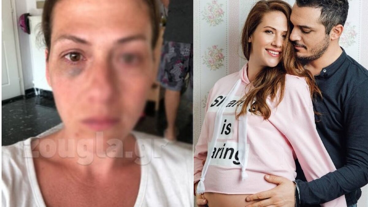 Συγκλονίζει η πρώην σύζυγος του Κώστα Δόξα: «Με έσπαγε συστηματικά στο ξύλο» - Fanpage